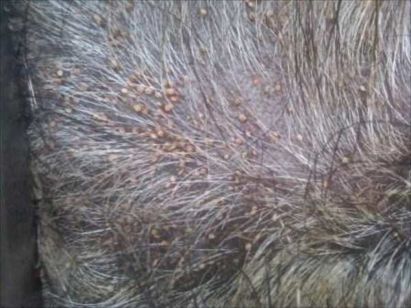 mange | Coyote Yipps